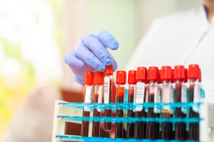 10 reasons why Blood Tests are important